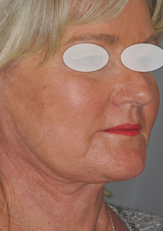 Dr DAN - Oculoplastic & Facial Cosmetic Surgery