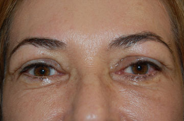 Dr DAN - Oculoplastic & Facial Cosmetic Surgery