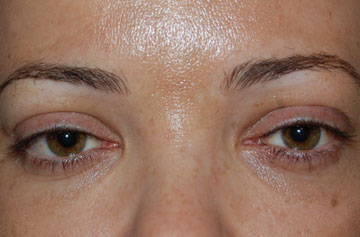 Dr DAN - Oculoplastic & Facial Cosmetic Surgery