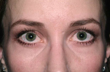 Dr DAN - Oculoplastic & Facial Cosmetic Surgery