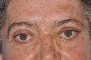 Dr DAN - Oculoplastic & Facial Cosmetic Surgery