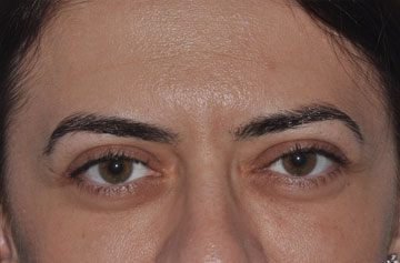 Dr DAN - Oculoplastic & Facial Cosmetic Surgery