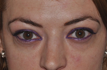 Dr DAN - Oculoplastic & Facial Cosmetic Surgery