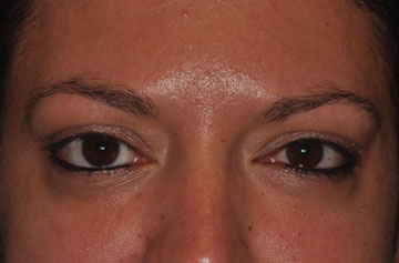 Dr DAN - Oculoplastic & Facial Cosmetic Surgery