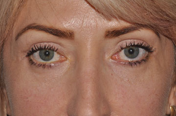 Dr DAN - Oculoplastic & Facial Cosmetic Surgery