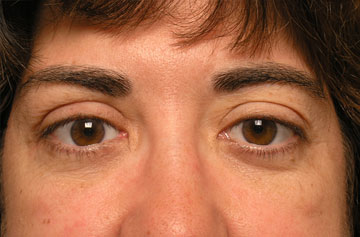 Dr DAN - Oculoplastic & Facial Cosmetic Surgery