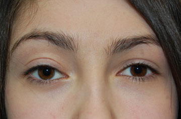 Dr DAN - Oculoplastic & Facial Cosmetic Surgery