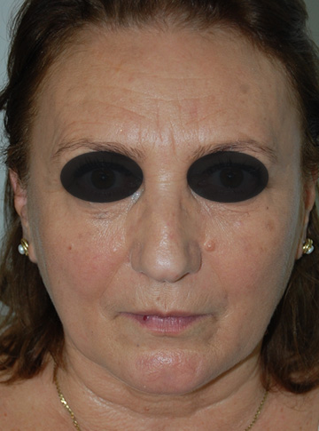 Dr DAN - Oculoplastic & Facial Cosmetic Surgery