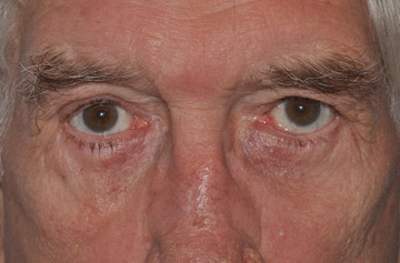 Dr DAN - Oculoplastic & Facial Cosmetic Surgery