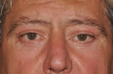 Dr DAN - Oculoplastic & Facial Cosmetic Surgery