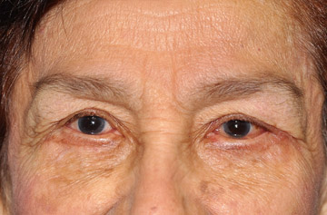 Dr DAN - Oculoplastic & Facial Cosmetic Surgery