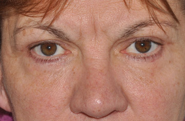 Dr DAN - Oculoplastic & Facial Cosmetic Surgery