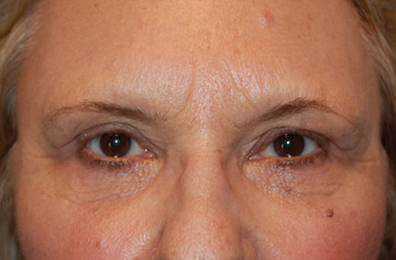 Dr DAN - Oculoplastic & Facial Cosmetic Surgery